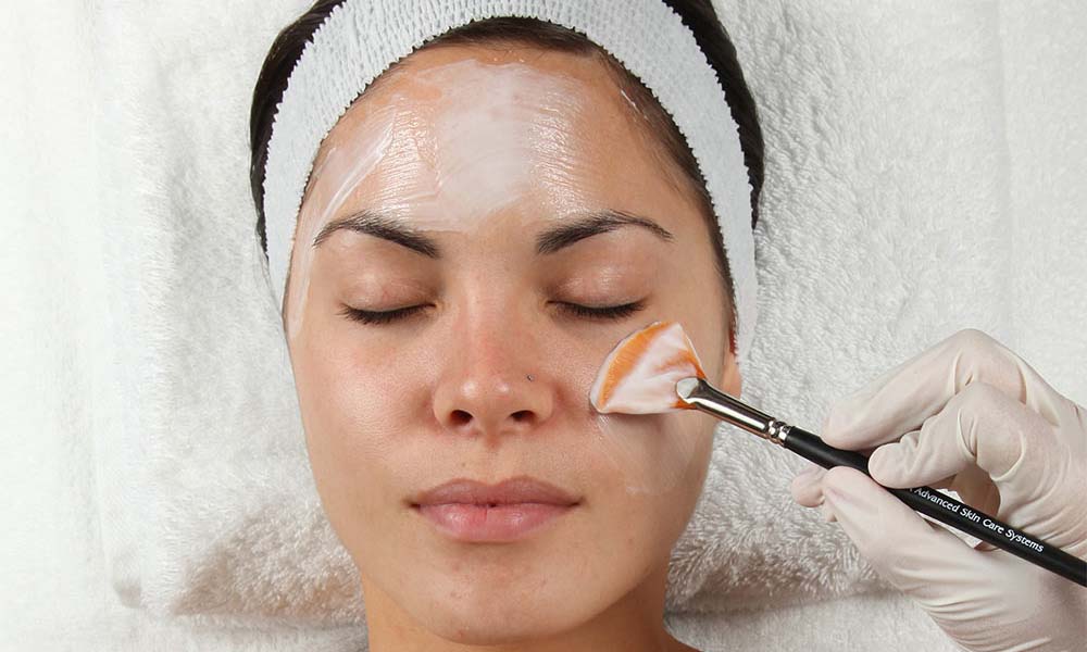 Skin Peels – Second Debut